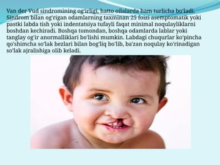 Anatomiya Lab-tanglay anomaliyasi. Ularda kuzatiladigan patologiyalar | PPT