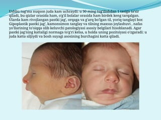 Anatomiya Lab-tanglay anomaliyasi. Ularda kuzatiladigan patologiyalar | PPT