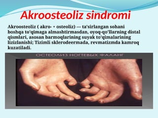 Anatomiya Lab-tanglay anomaliyasi. Ularda kuzatiladigan patologiyalar | PPT