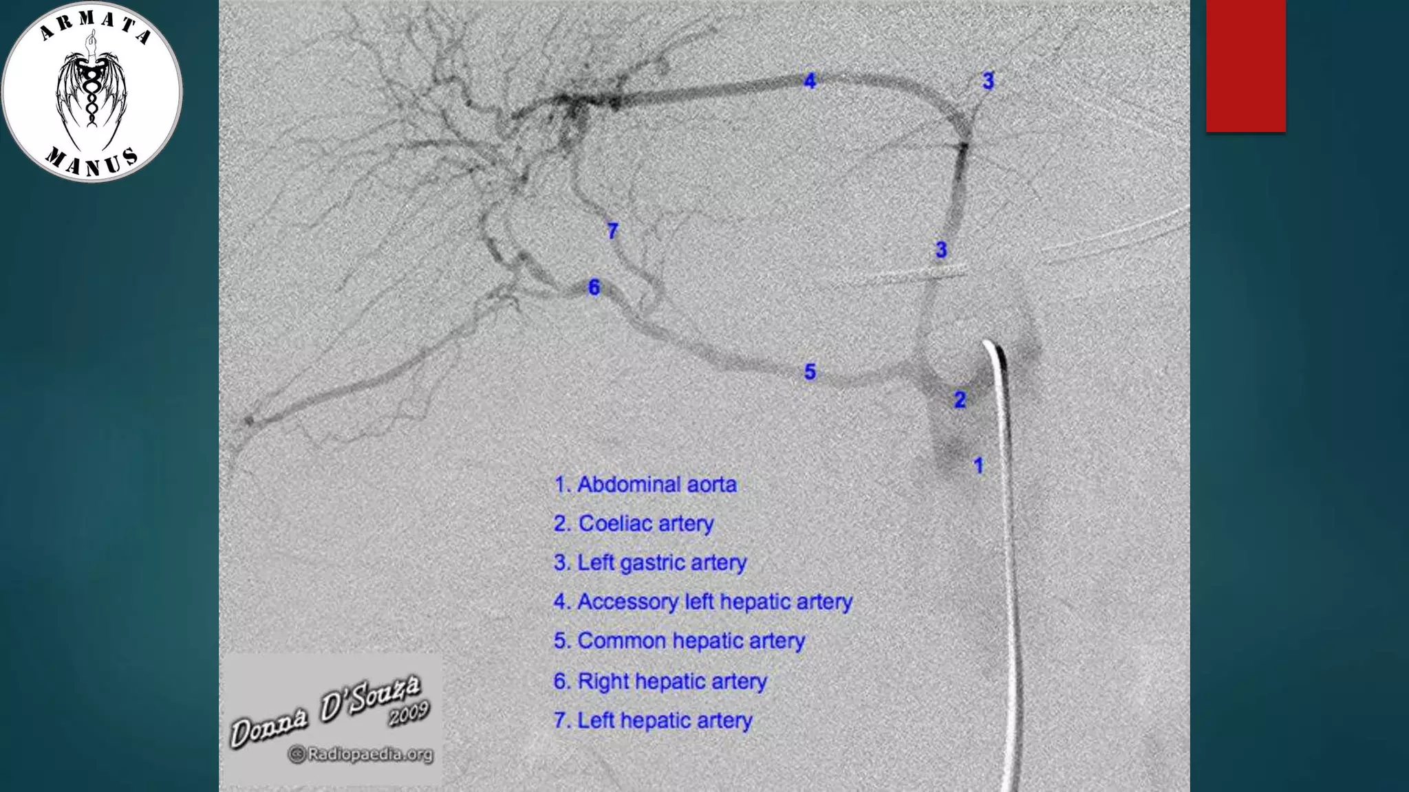 Anatomy of liver hilum | PPTX