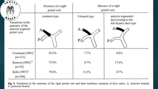 Anatomy of liver hilum | PPTX
