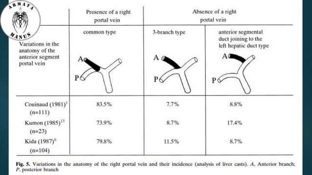 Anatomy of liver hilum | PPTX