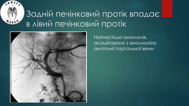 Anatomy of liver hilum | PPTX