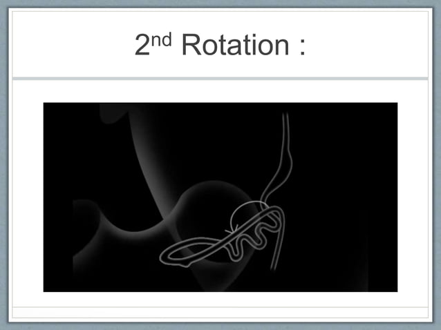 Rotation of gut | PPTX | Digestive Disorders | Diseases and Conditions