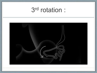 Rotation of gut | PPTX | Digestive Disorders | Diseases and Conditions