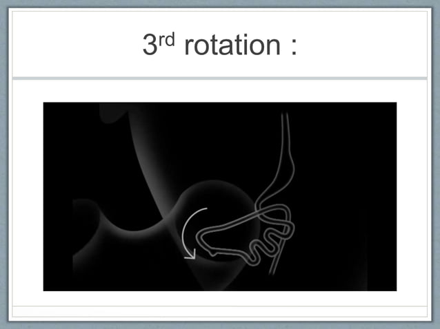 Rotation of gut | PPTX | Digestive Disorders | Diseases and Conditions