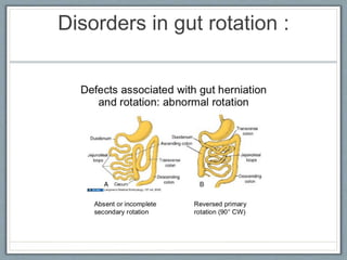 Rotation of gut | PPTX