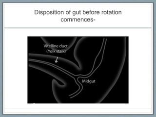 Rotation of gut | PPTX