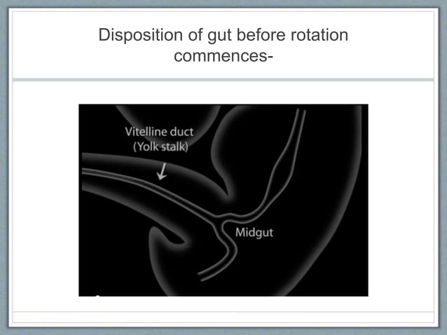 Rotation of gut | PPTX | Digestive Disorders | Diseases and Conditions