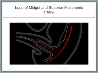 Rotation of gut | PPTX