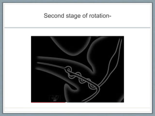 Rotation of gut | PPTX | Digestive Disorders | Diseases and Conditions