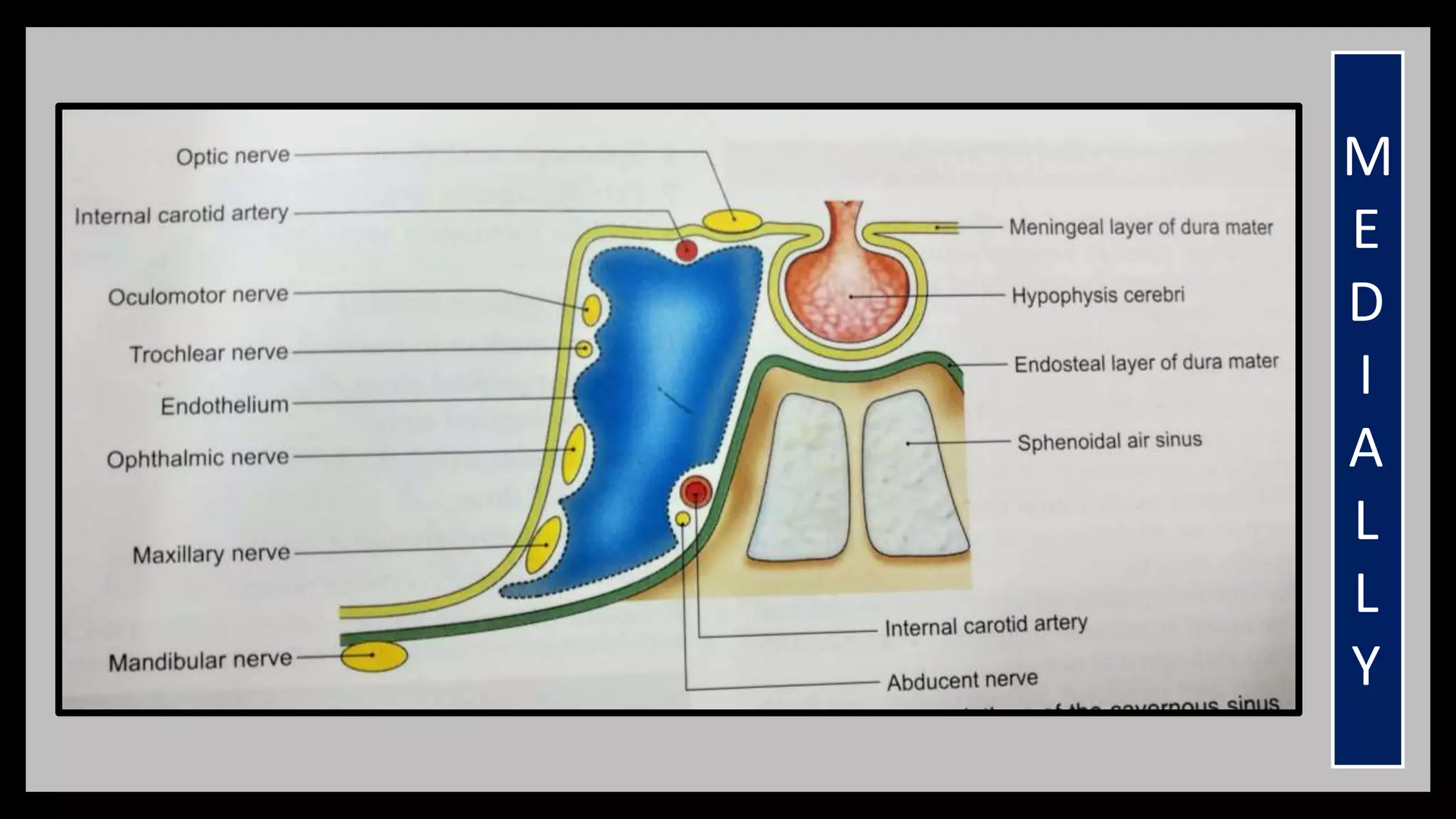 venous dural sinuses and cavenous venous sinus | PPT