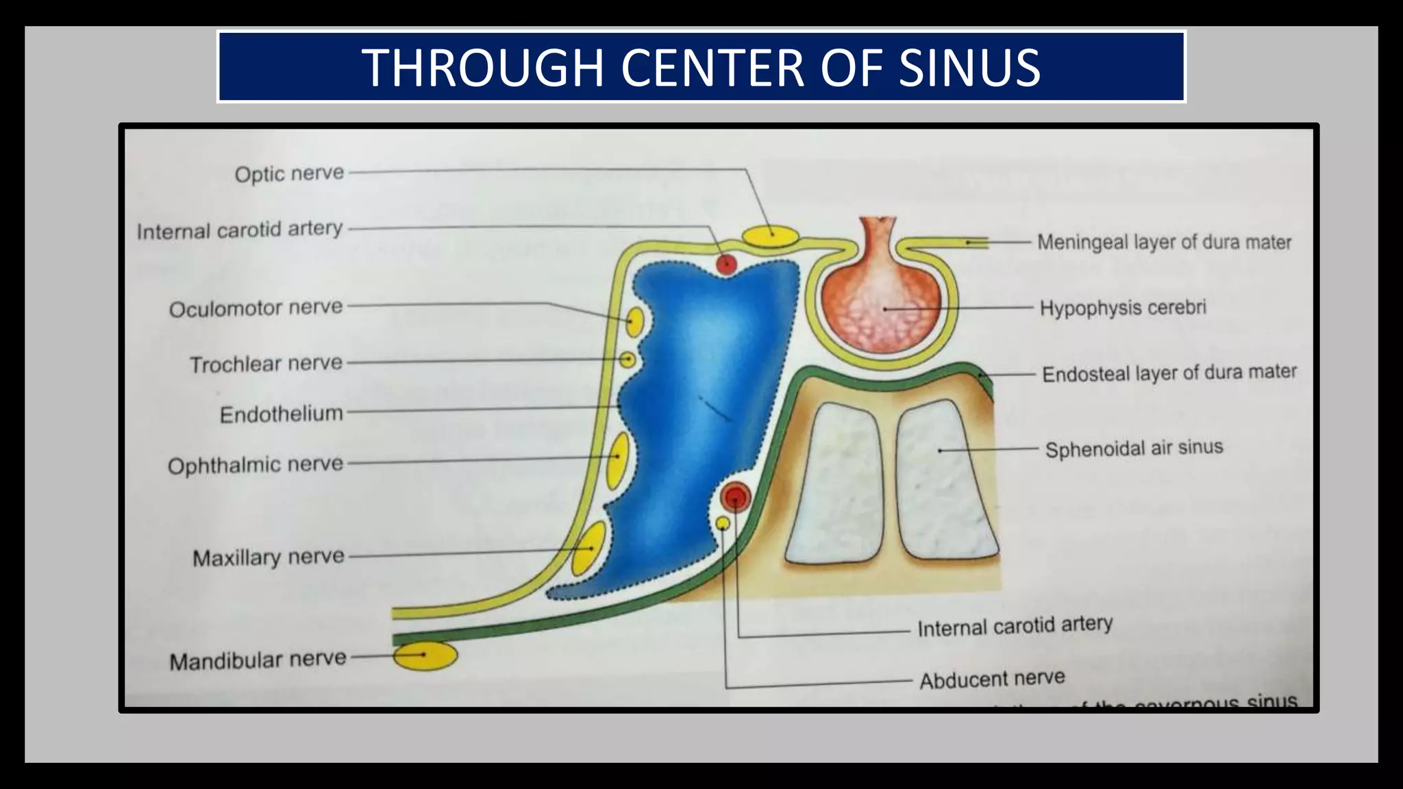 venous dural sinuses and cavenous venous sinus | PPT