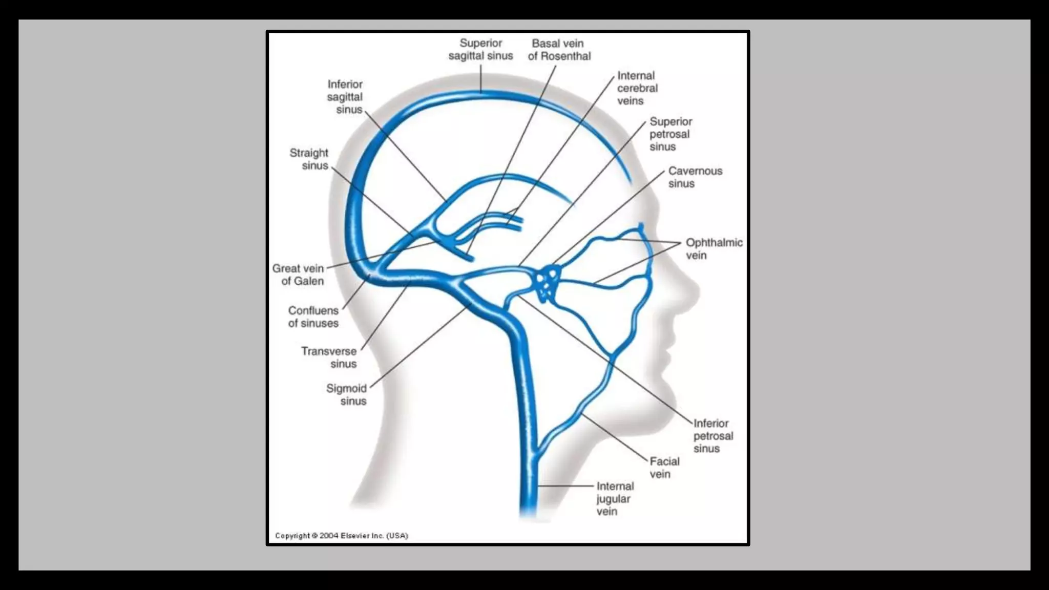 venous dural sinuses and cavenous venous sinus | PPT