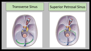 venous dural sinuses and cavenous venous sinus | PPT