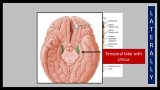 venous dural sinuses and cavenous venous sinus | PPTX