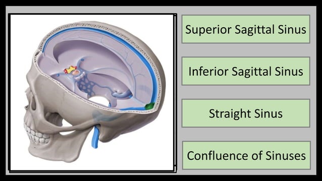 venous dural sinuses and cavenous venous sinus | PPT