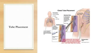 Anatomy of Thorax | PPTX