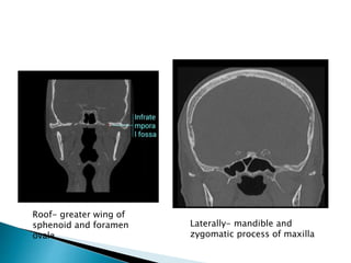 Radiological anatomy of infra temporal fossa | PPTX