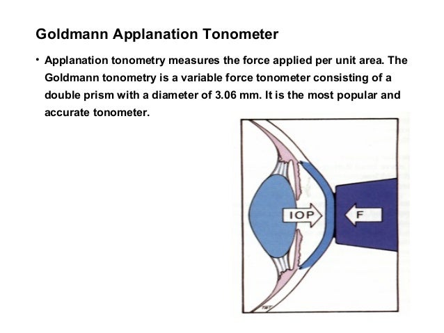 Anatomy of the angle structure (glaucoma)