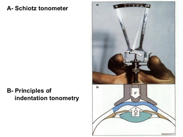 Anatomy of the angle structure (glaucoma)