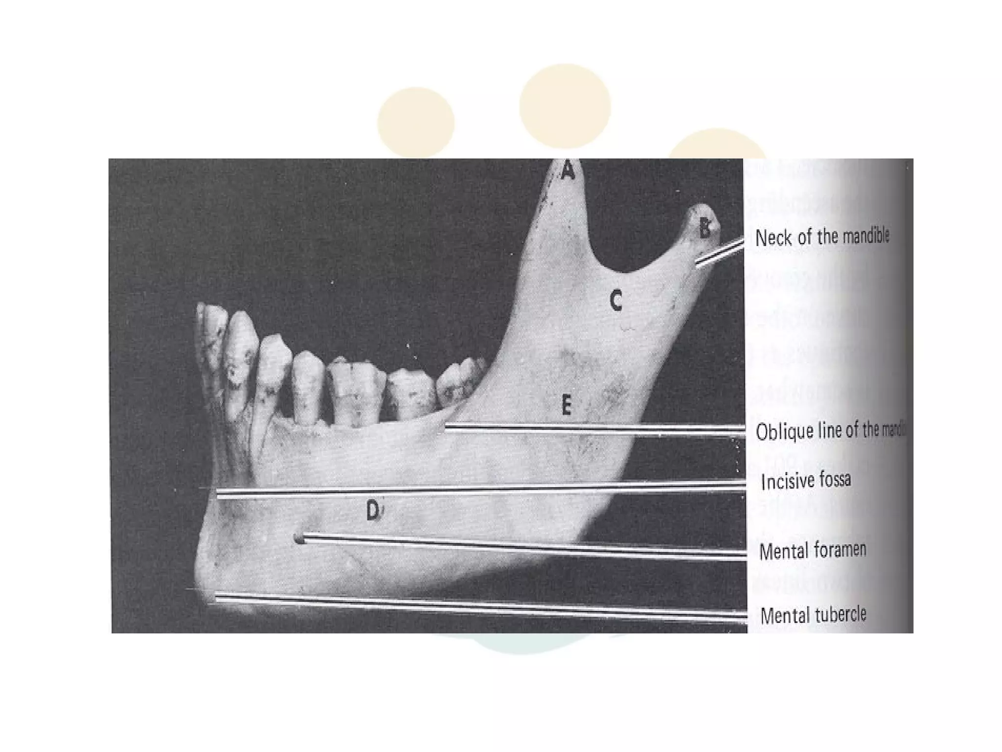 Anatomy and-fractures-of-the-mandible | PPT