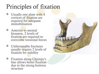 Anatomy and-fractures-of-the-mandible | PPT