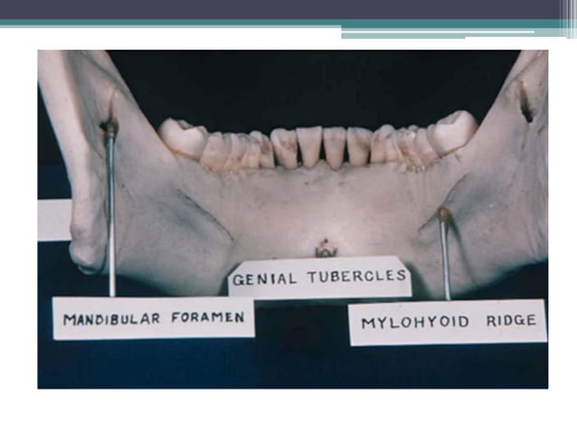 Anatomy complete denture | PDF