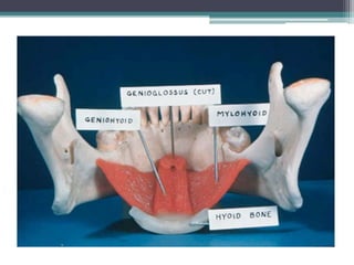 Anatomy complete denture | PDF