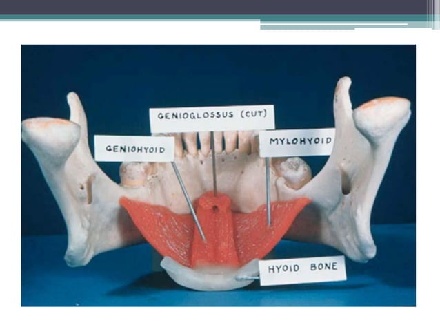 Anatomy complete denture | PDF