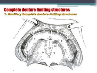 Anatomy complete denture | PDF