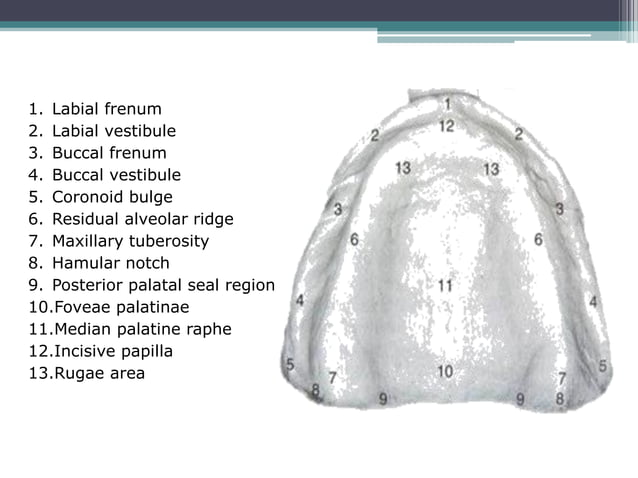 Anatomy complete denture | PDF