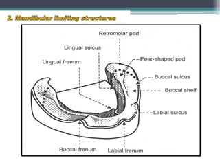 Anatomy complete denture | PDF