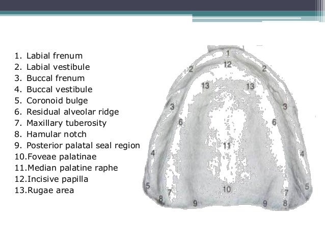 Anatomy complete denture