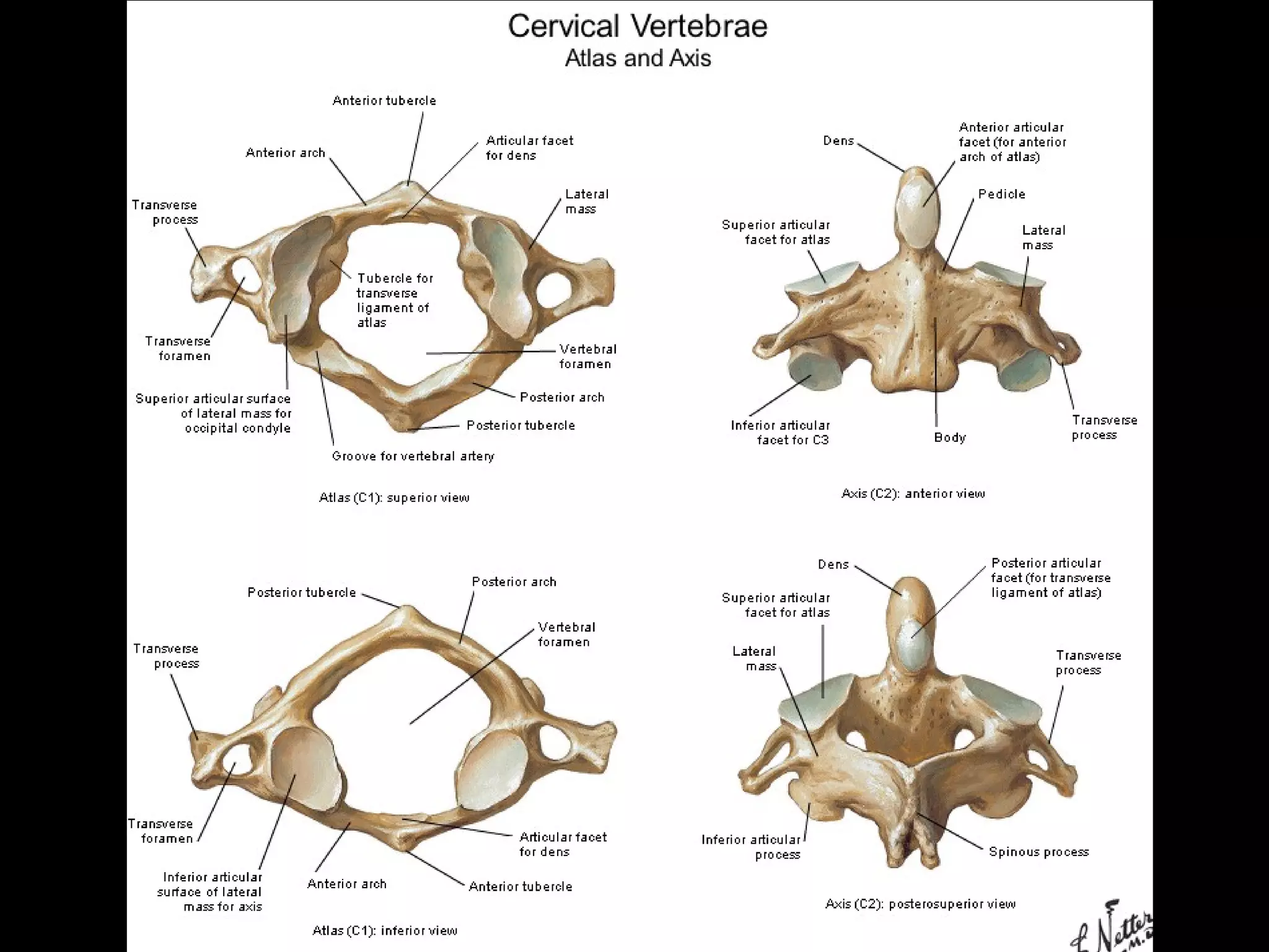 Anatomy Lect 5 Trunk & Spine | PPT