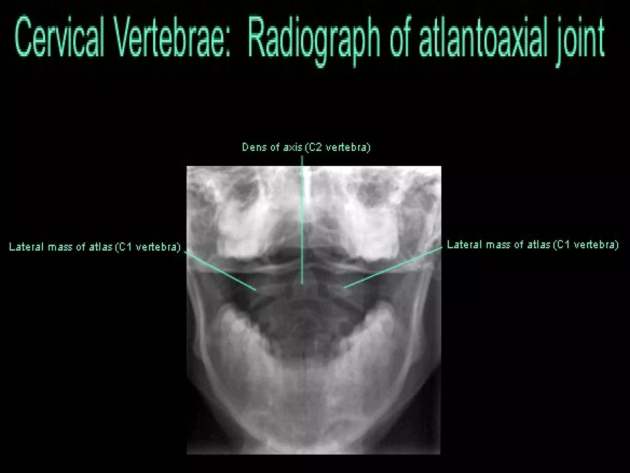 Anatomy Lect 5 Trunk & Spine | PPT