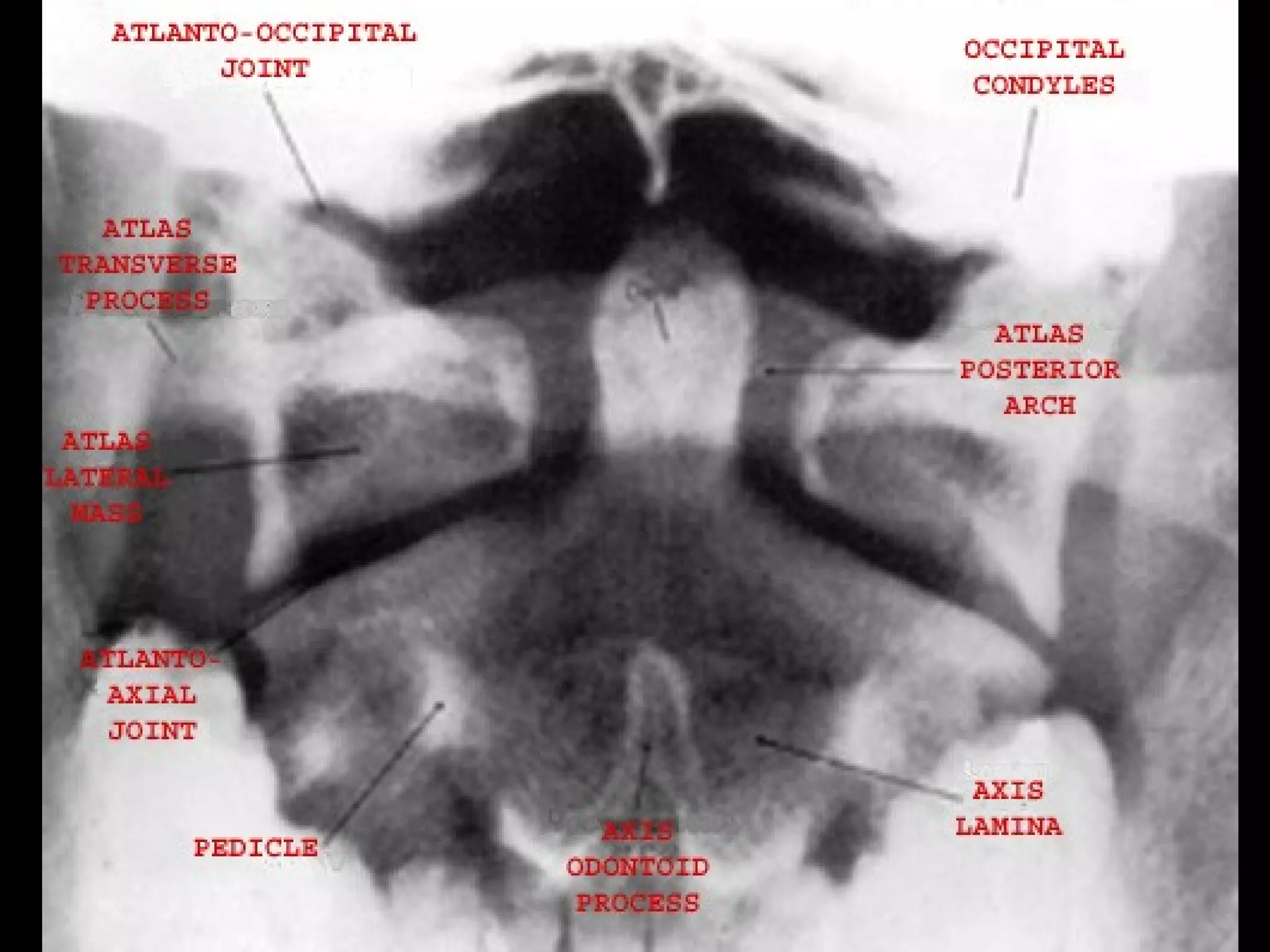 Anatomy Lect 5 Trunk & Spine | PPT