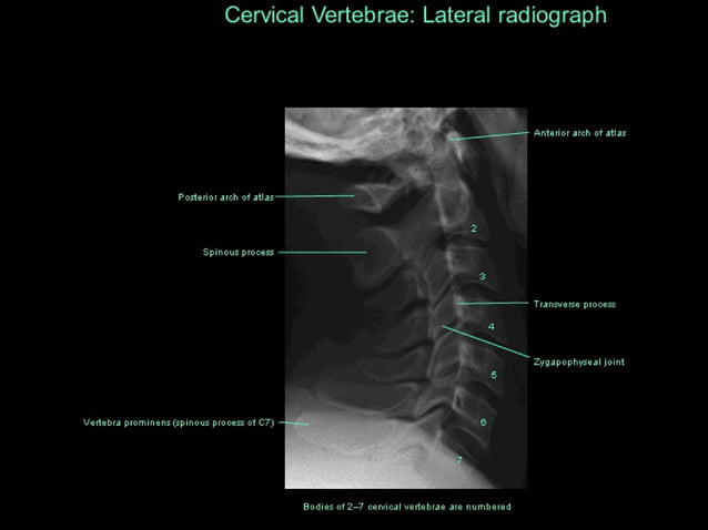 Anatomy Lect 5 Trunk & Spine | PPT