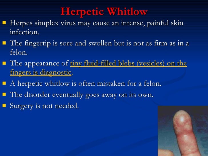 anatomia extremidad superior