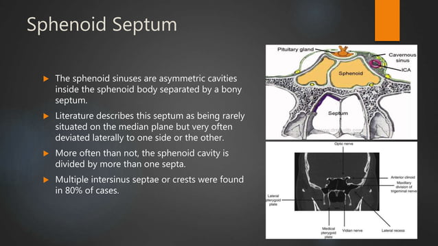 Nasal Cavity and Sphenoid Sinus Anatomy | PPTX