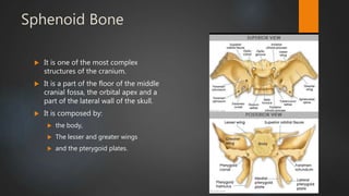 Sphenoid Bone Labeled