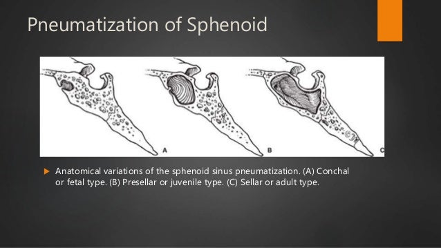 Nasal Cavity and Sphenoid Sinus Anatomy