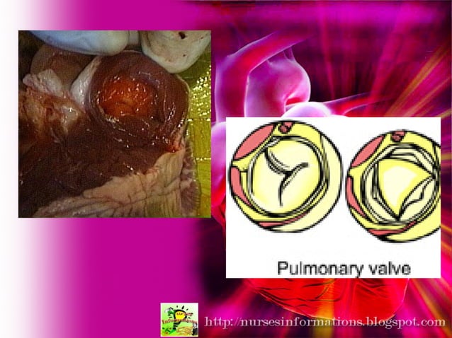 Anatomy Of Cardiovasvular System | PPT | Heart and Cardiovascular ...