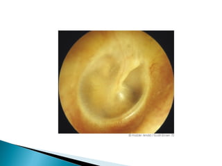 Anatomy Physiology of ear | PPT