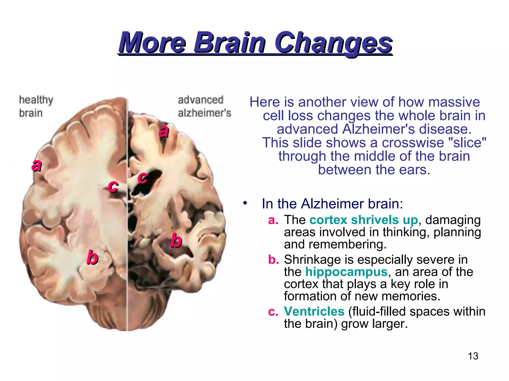 Anatomy Of Human Brain | PPT