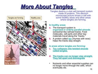 Anatomy Of Human Brain | PPT