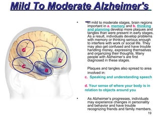 Anatomy Of Human Brain | PPT