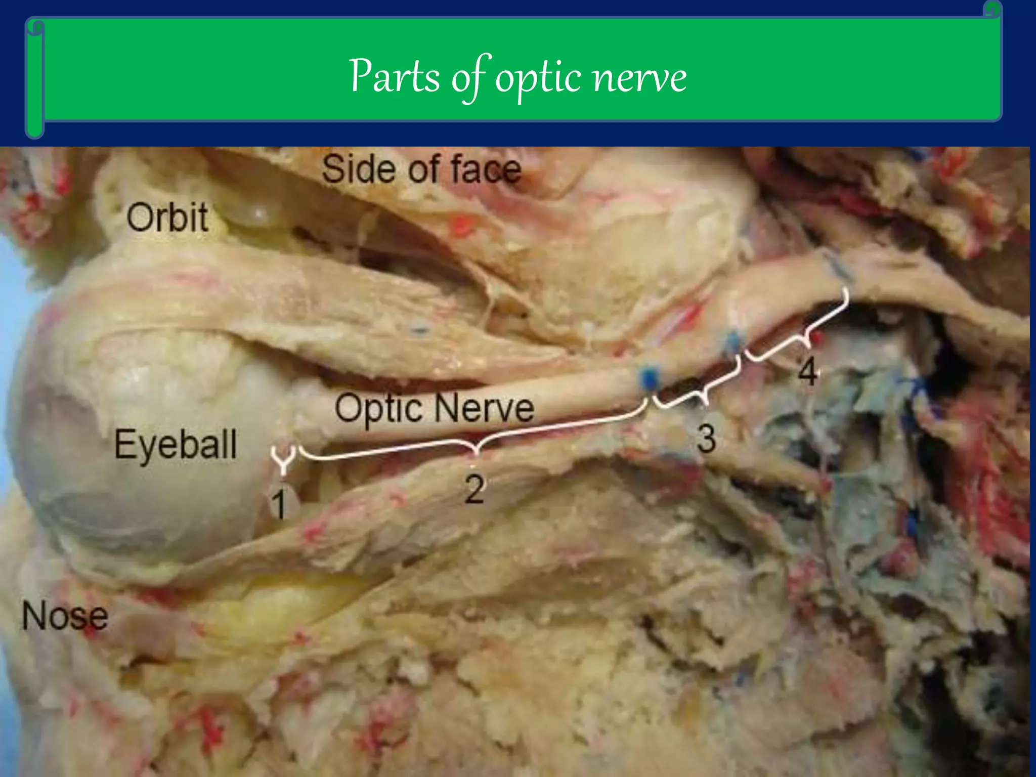 Anatomy of Optic Nerve | PPTX