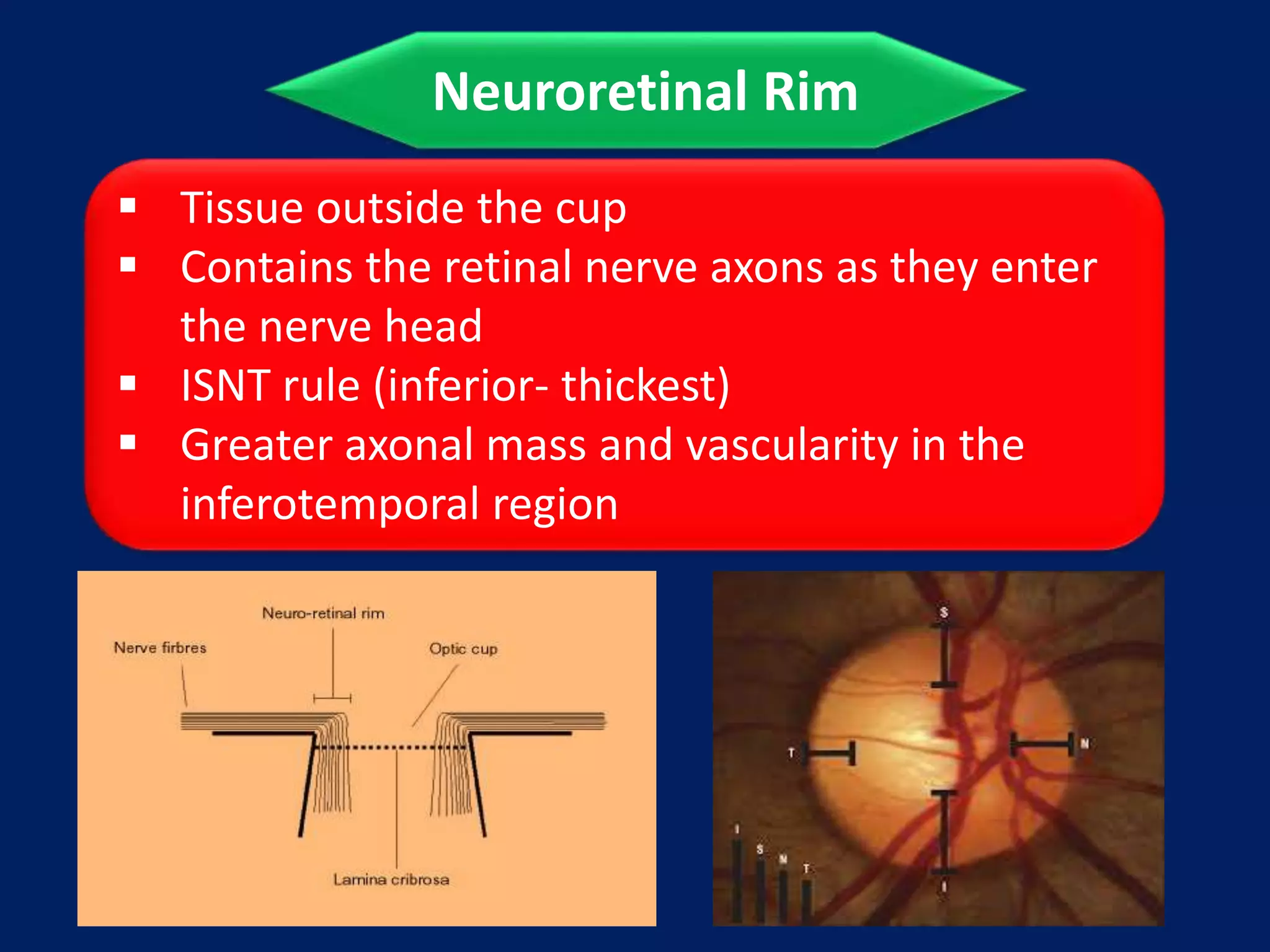 Anatomy of Optic Nerve | PPTX