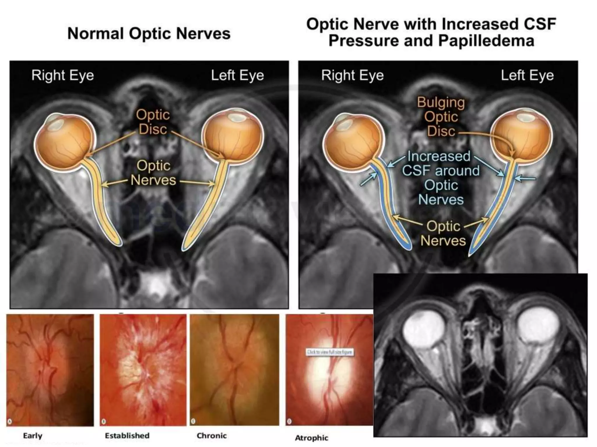 Anatomy of Optic Nerve | PPTX